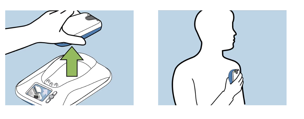 How to send a manual transmission with Medtronic – Vector Remote Care